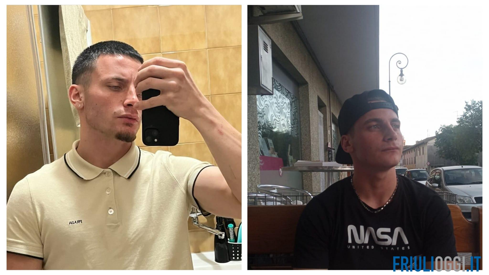 Scooter contro il muretto, Arben Dautaj muore in ospedale